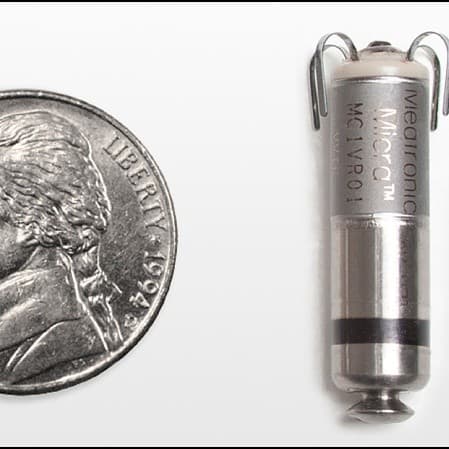 WORLD'S SMALLEST PACEMAKER REVEALED | Industry Update Manufacturing Media